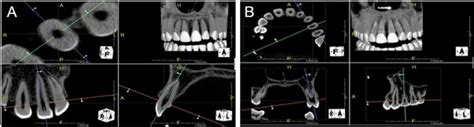 Three Dimensional Multiplanar Reconstructions A Selection Of Download Scientific Diagram