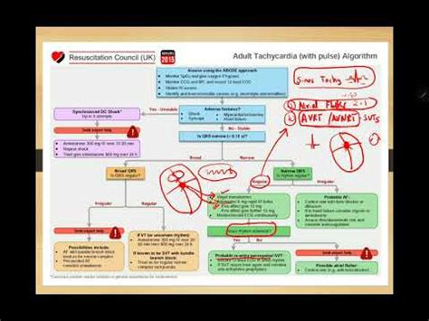 Tachycardias ALS Algorithm Explained YouTube
