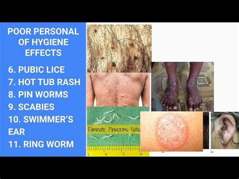 Poor Personal Hygiene Effects