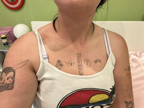 Got The Dreaded Rash Sjs R Lamictal