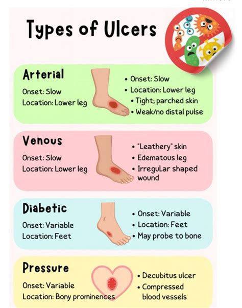 Understanding Ulcers Causes Locations And Types Dr S 0 Mikaye