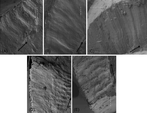 Scanning Electron Microscope Images Sem Of Naturally Broken Enamel Download Scientific