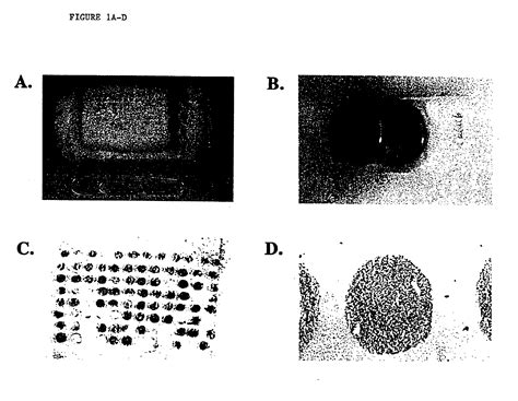 Frozen Tissue Microarray Technology For Analysis Rna Dna And Proteins