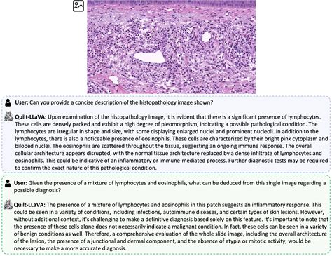 Quilt Llava Visual Instruction Tuning By Extracting Localized