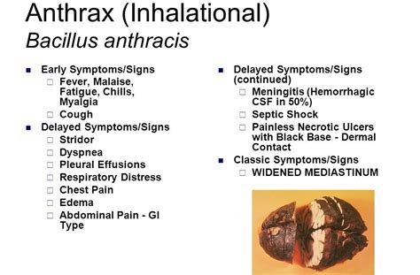 Anthrax Midwives Revision