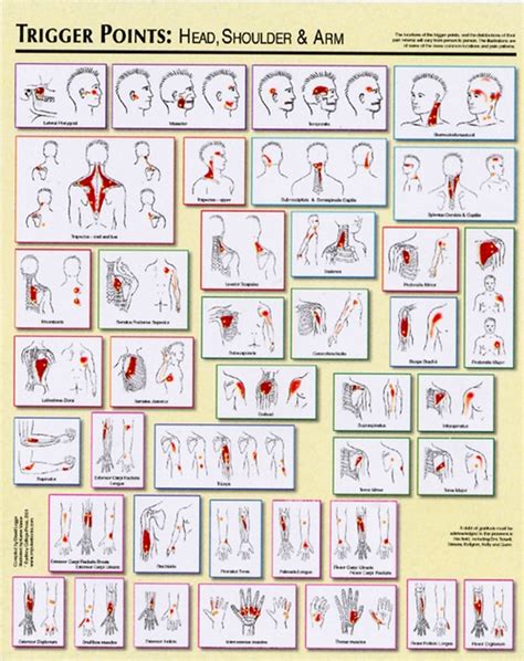 Printable Trigger Points Chart Printable Word Searches