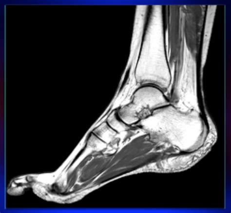 Rotc Flashcards Quizlet