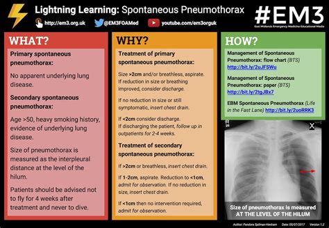 Spontaneous Pneumothorax