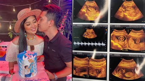 អបអរសាទរ ប៉ែន ស្រីពេជ្រ សម្រេចបំណងជូនស្វាមីពេលនេះពពោះកូនដំបូងហើយ Sabay News