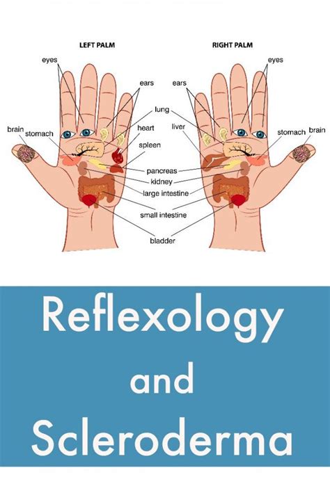 6 Types Of Scleroderma Artofit