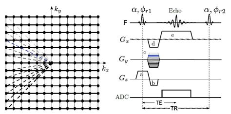 11 generic spoiled gradient echo sequence diagram gradients a