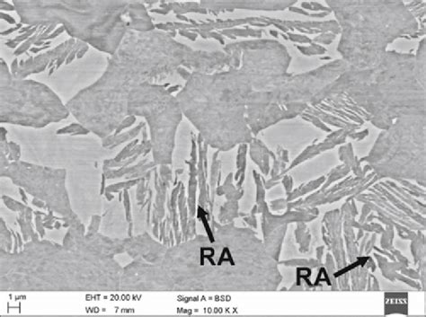 The Sem Micrograph Showing The Morphology Of Bainitic Islands