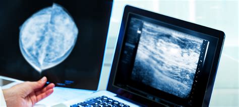 Mammography Associate Apprentices Reach 100 Across England Intelligent Healthtech