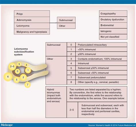 Uterine Fibroids Specific Size