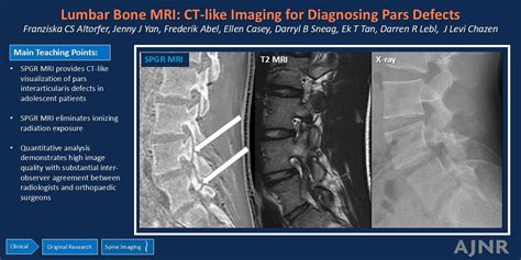 Lumbar Spine Bone Mri A Radiation Free Approach Utilizing Ct Like