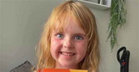 Darcee 5 Is Cover Star Of Book Explaining Her Skin Condition To