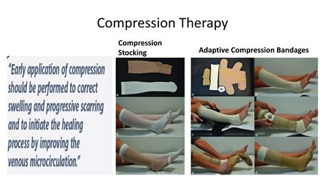 Chronic Venous Disease From Pathogenesis To Clinical Practice Ppt