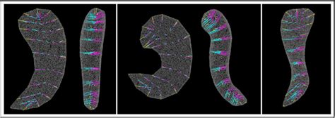 Skeletal Deformation By LP Ds Rep Left A Ds Rep With Its Implied