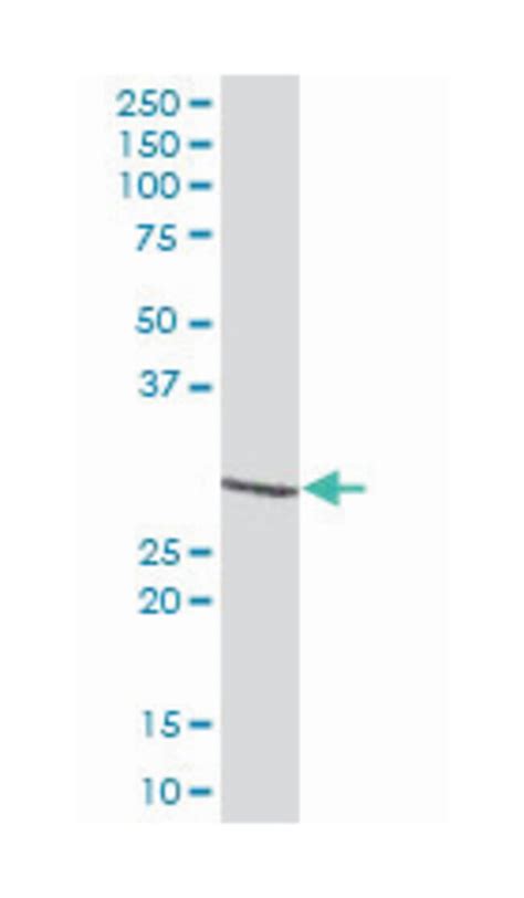 Diablo Homolog Drosophila Mouse Polyclonal Antibody Abnova 50μl