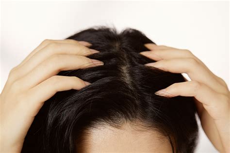 나도 탈모일까 탈모 자가진단과 증상에 관한 Faq 모아보기 닥터나우 나도 탈모일까 탈모 자가진단과 증상에 관한 Faq 모아보기 닥터나우