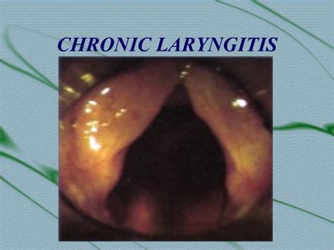 Acute And Chronic Laryngeal Inflammation