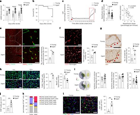 年龄引起的粒细胞生成改变会产生非典型中性粒细胞，从而加剧中风病理学 Nature Immunology X Mol