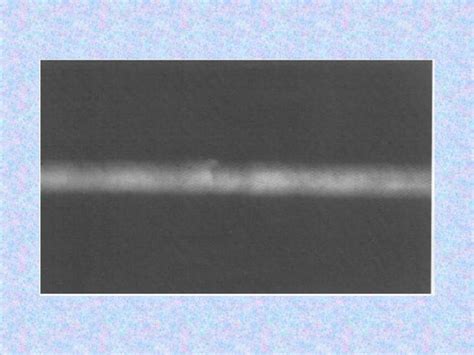 Types Of Radio Graphic Rt Weld Examination Defects Ppt Medical Tests Medical Health