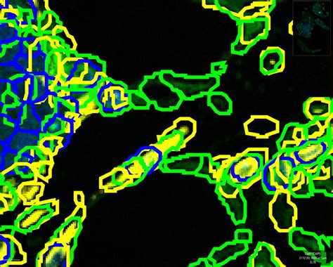 Combine Multiple Cell Segmentations In Cellpose Image Analysis Image Sc Forum