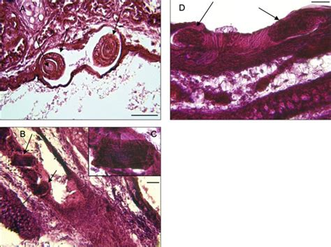 Trichosomoides Nasalis Arrows In The Pseudostratified Epithelium A