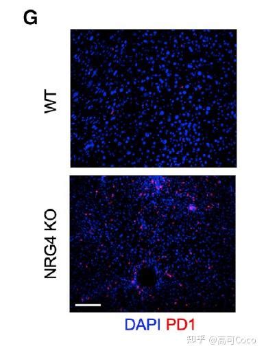 001 文献分析分享：普通转录组 单细胞分析 巨噬细胞分群 （2） 知乎