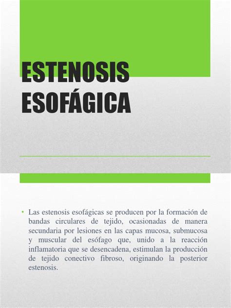Estenosis EsofÁgica Quemar La Enfermedad Por Reflujo Gastroesofágico