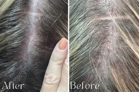 Nourish The Root With A Restorative Scalp Health Treatment By Essential Spa Located In Sylvania