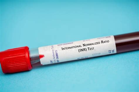 International Normalized Ratio Inr Test Stock Image Image Of Used