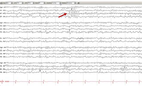 The Eeg Game A Game Based Educational Tool