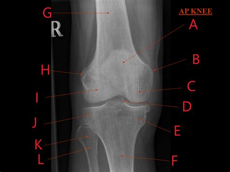 Diagram Of Knee Anatomy Ap Quizlet