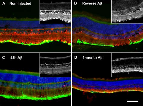 Figure 5 From Differential Effects Of Amyloid β Peptide Aggregation