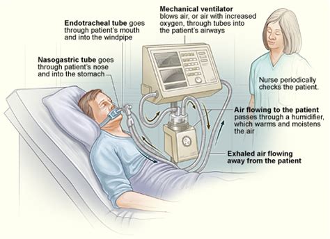 Biomedicalism Medical Ventilation Machine