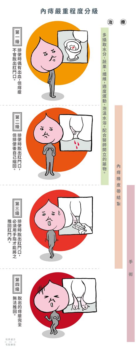 痔瘡症狀有分1 4級，圖解改善方法與手術時機！｜家天使 臨時看護第一選擇