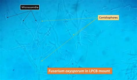 Fusarium Morphology Classification Pathogenecity Laboratory Diagnosis