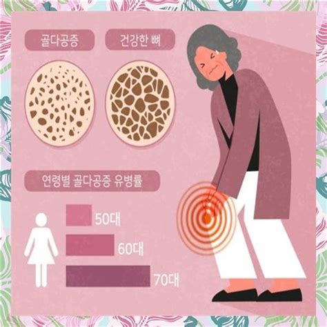 골다공증 증상 관리할 골다공증 약 찾고 있다면 주목하세요 네이버 포스트