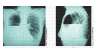 RCP Ch Ch Flashcards Quizlet