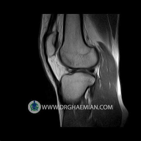 ام آر آی مفاصل تحتانی چیست و چرا انجام می شود؟ مرکز تصویر برداری دکتر