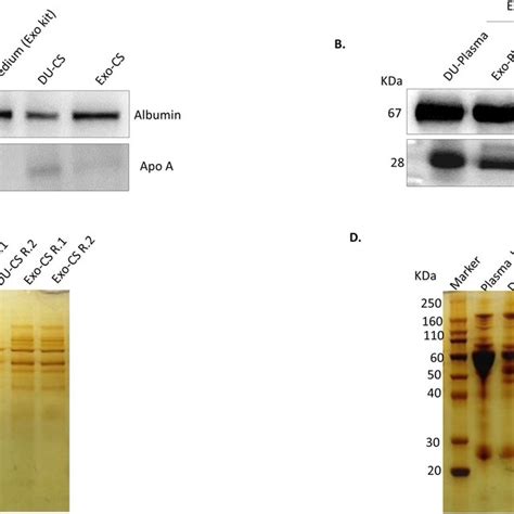 Reduced Amount Of HDL Is Co Isolated In ExoEasy Kit Preparations A
