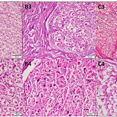 Photomicrographs Of Transverse Sections In Cadaveric Median Nerve