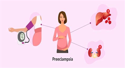 Preeclampsia Causes Symptoms Diagnosis And Treatment