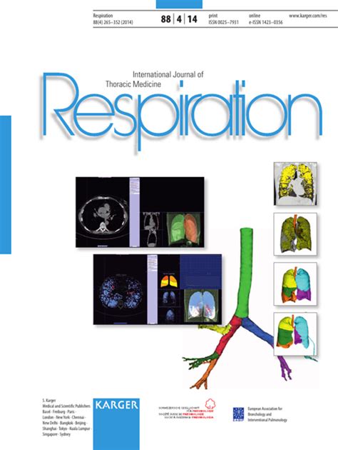 Correlation Between Collateral Ventilation And Interlobar Lung Fissures