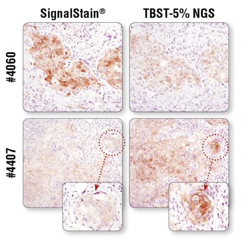 Immunohistochemistry IHC Troubleshooting And Using Controls Cell Signaling Technology