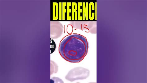 🩸cómo Identificar Al Eritroblasto BasÓfilo ¿cuales Son Sus Características Morfológicas🔬