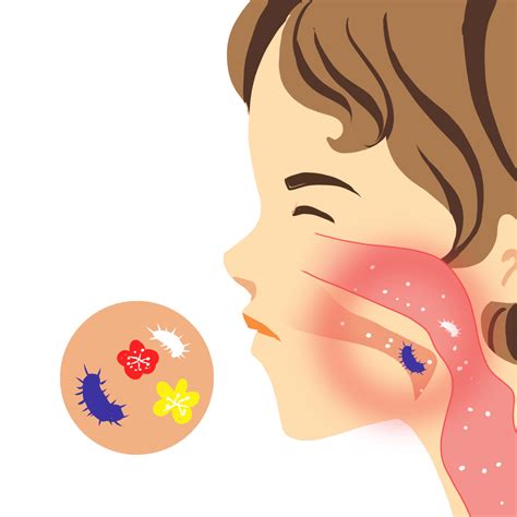 已进入高发季！国家卫健委最新答疑诊疗儿童孩子