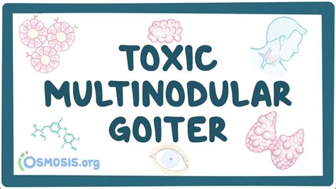 Toxic Multinodular Goiter Video Causes And Meaning Osmosis
